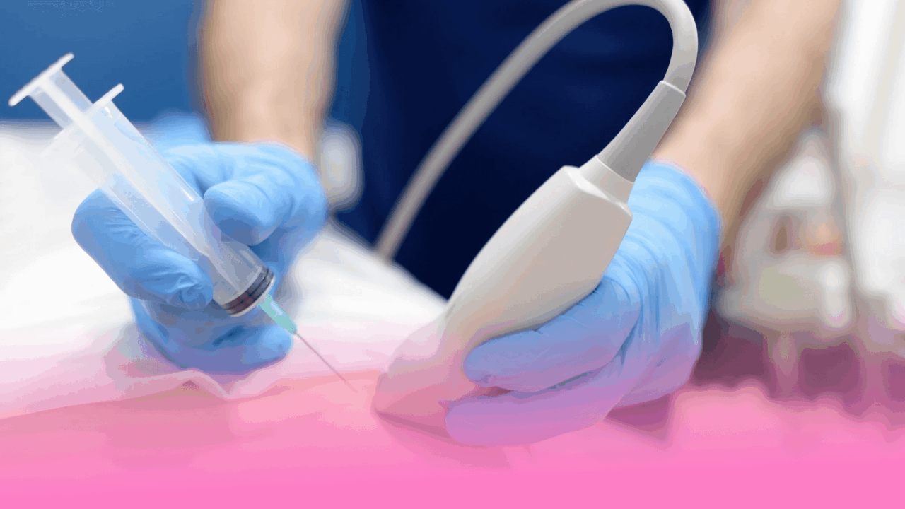 Conociendo el cáncer de mama - AMLCC | Asociación Mexicana de Lucha Contra el Cáncer